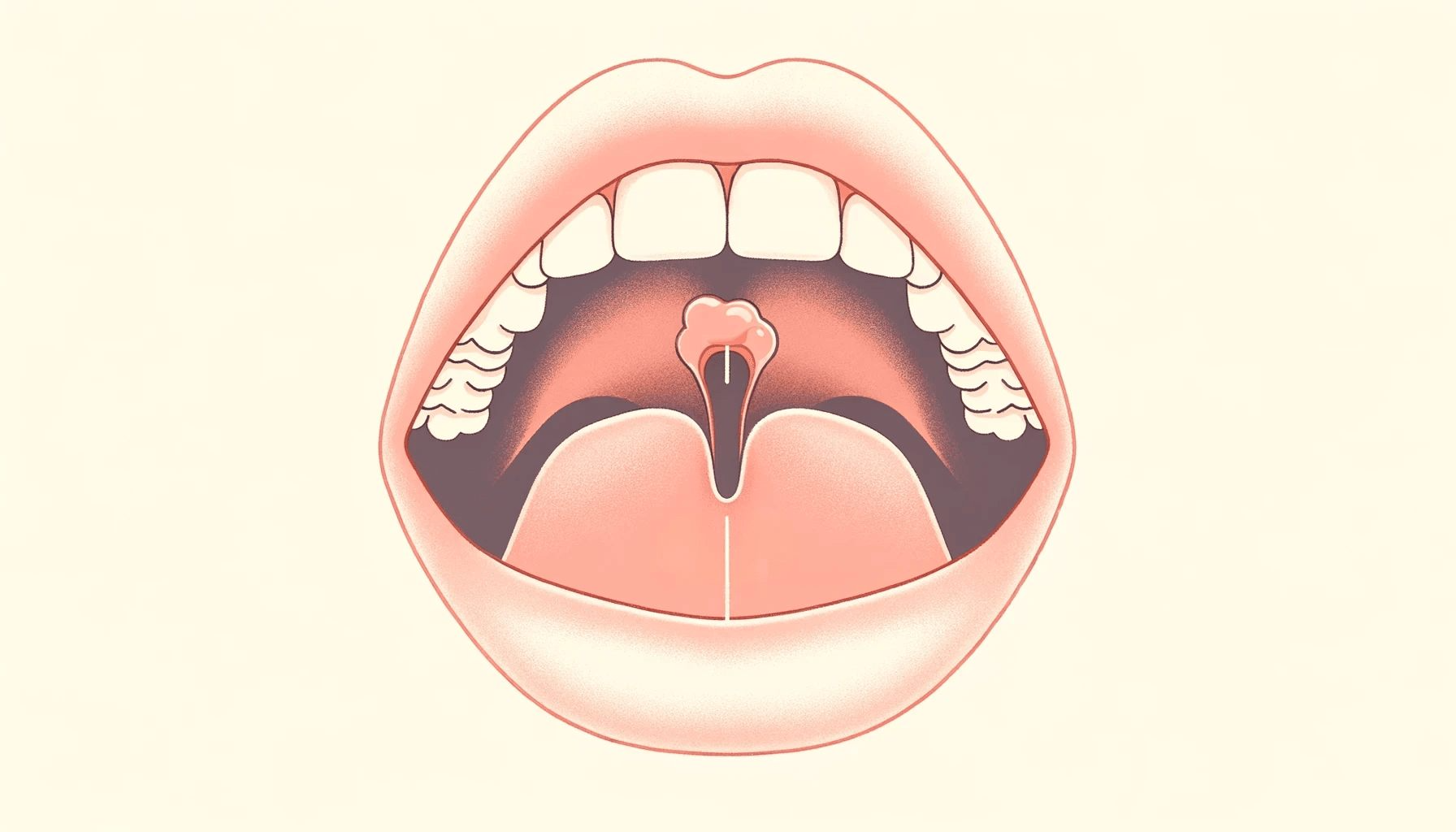 Torus Palatinus: Symptoms, Causes, and Effective Treatments